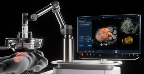 HistoSonics Notches Significant Reimbursement Wins